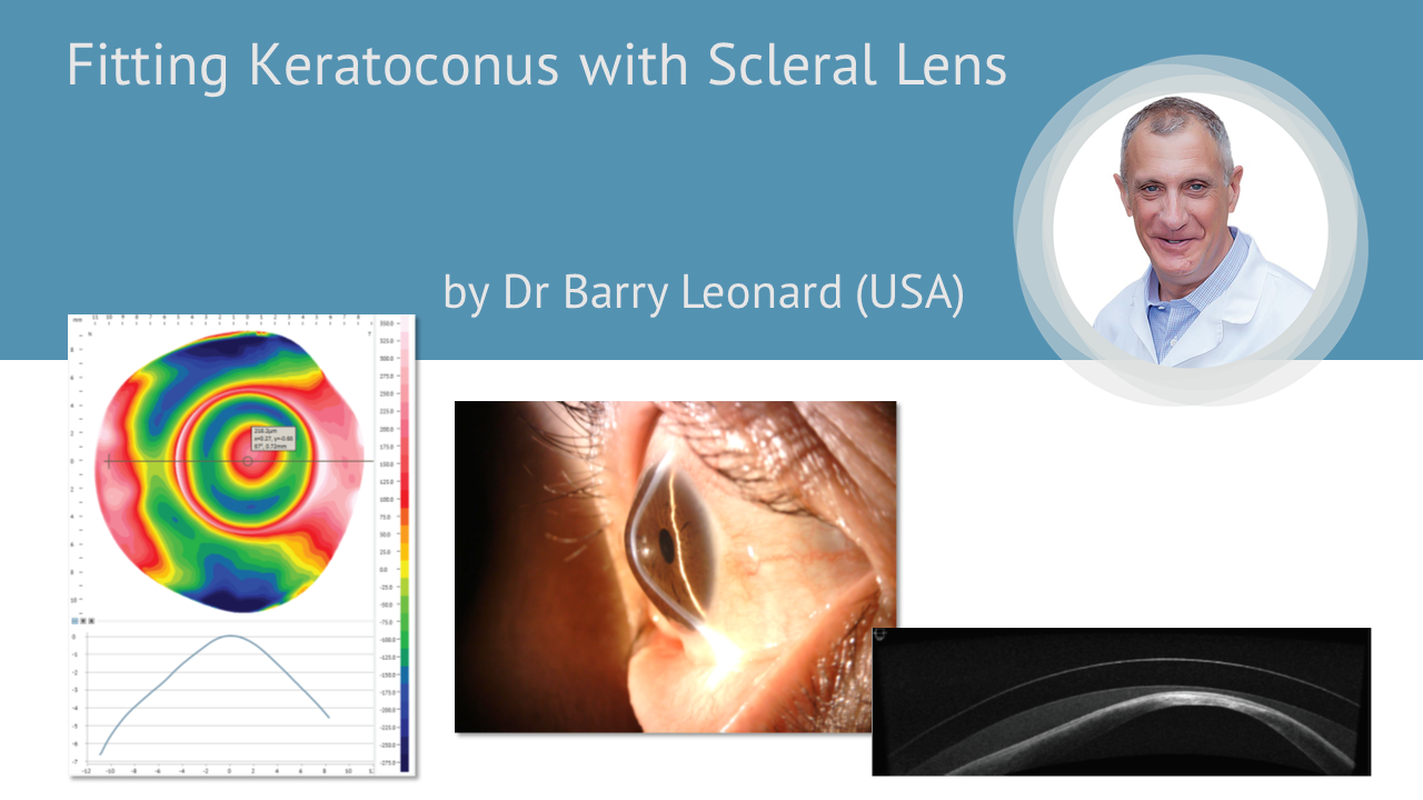 DirectConnect Zenlens Fitting Guide