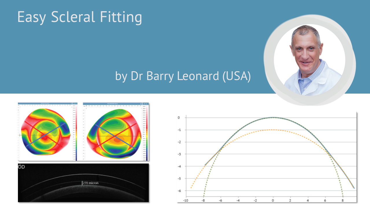Zenlens by Bausch+Lomb: Easy fit with the Eye Surface Profiler