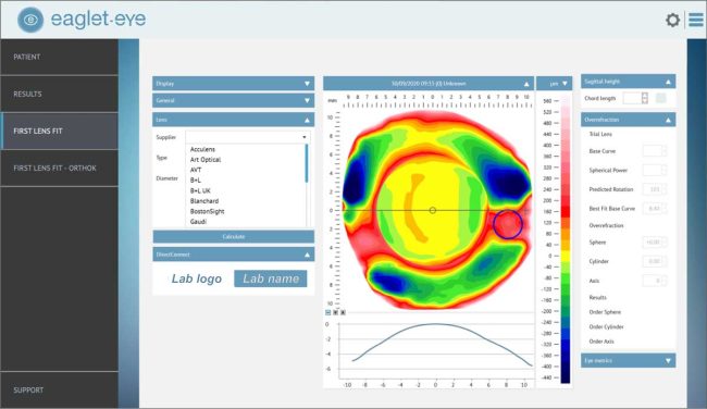 DirectConnect Zenlens Fitting Guide