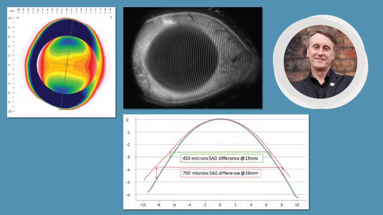 Zenlens by Bausch+Lomb: Easy fit with the Eye Surface Profiler